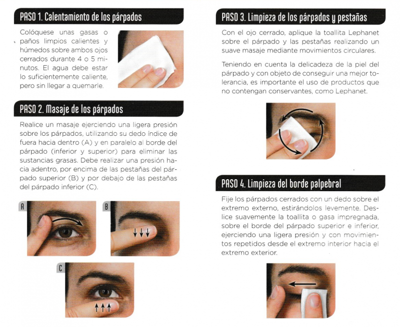 ¿Qué es la blefaritis? Causas y tratamiento | IOTT | Tus ojos en las ...