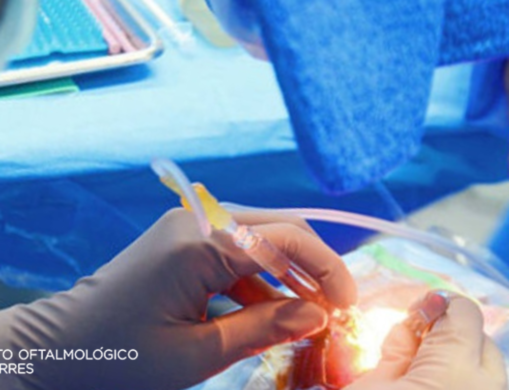 Las dioptrías: qué son y cómo se miden | IOTT | Tus ojos en las mejores ...